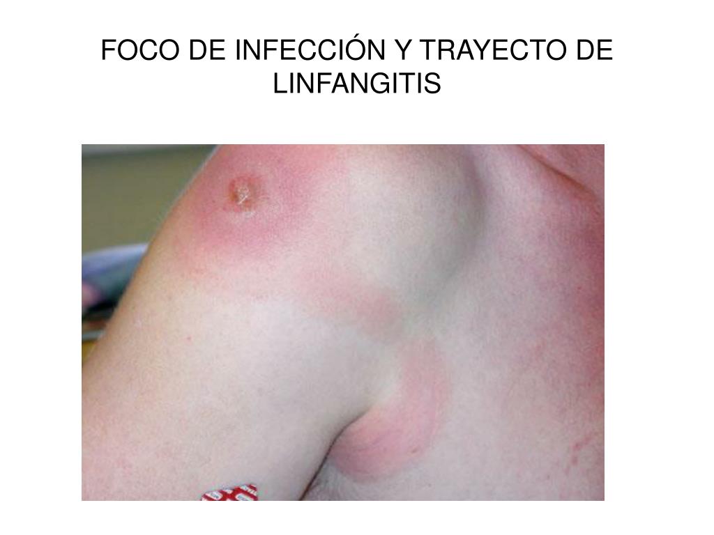 PPT - ANATOMÍA PATOLÓGICA GENERAL 3º CURSO. 2010 PowerPoint ...