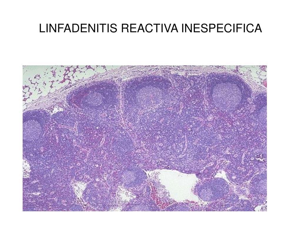 PPT - ANATOMÍA PATOLÓGICA GENERAL 3º CURSO. 2010 PowerPoint ...