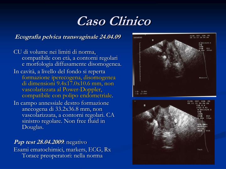 PPT - POLIPO ENDOMETRIALE PowerPoint Presentation - ID:980870