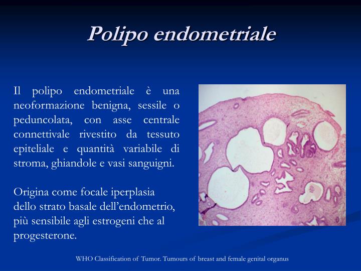 PPT - POLIPO ENDOMETRIALE PowerPoint Presentation - ID:980870