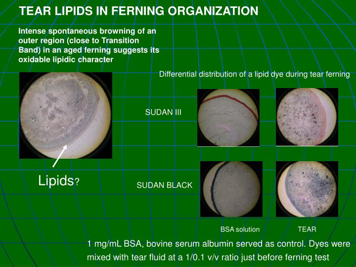 PPT - NEW INSIGHTS INTO THE TEAR FERNING TEST FOR DRY EYE PowerPoint ...