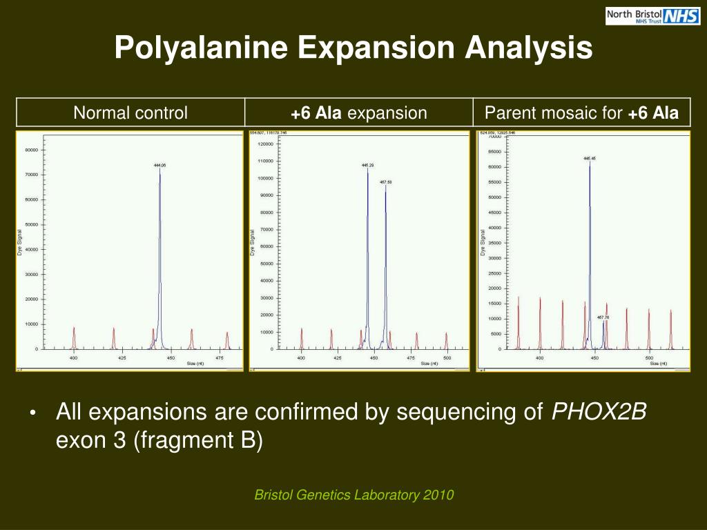 PPT - Congenital Central Hypoventilation Syndrome: Understanding a Rare ...