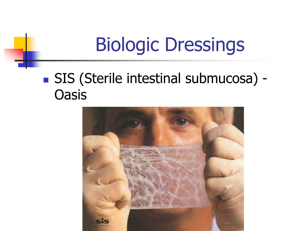 PPT - Wound Care Dressings and Their Uses PowerPoint Presentation, free ...