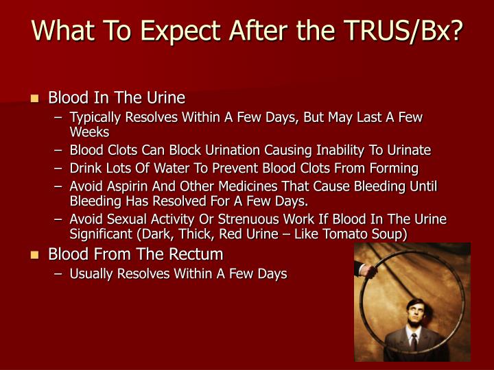 PPT - Transrectal Ultrasound and Prostate Biopsy PowerPoint ...