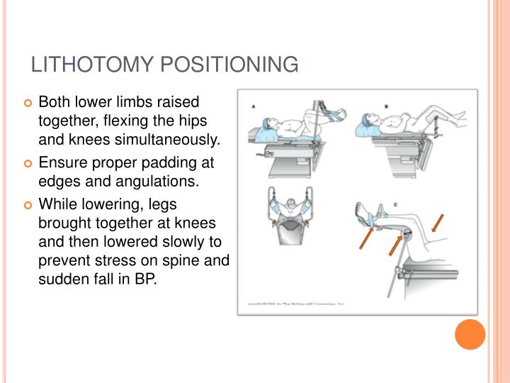 PPT - ANAESTHETIC MANAGEMENT OF ENDOSCOPIC UROLOGIC PROCEDURES ...