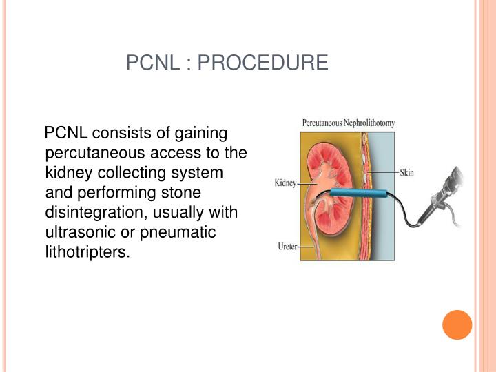 PPT - ANAESTHETIC MANAGEMENT OF ENDOSCOPIC UROLOGIC PROCEDURES ...