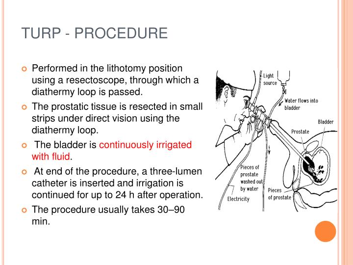 PPT - ANAESTHETIC MANAGEMENT OF ENDOSCOPIC UROLOGIC PROCEDURES ...