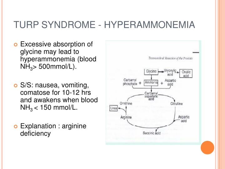 PPT - ANAESTHETIC MANAGEMENT OF ENDOSCOPIC UROLOGIC PROCEDURES ...