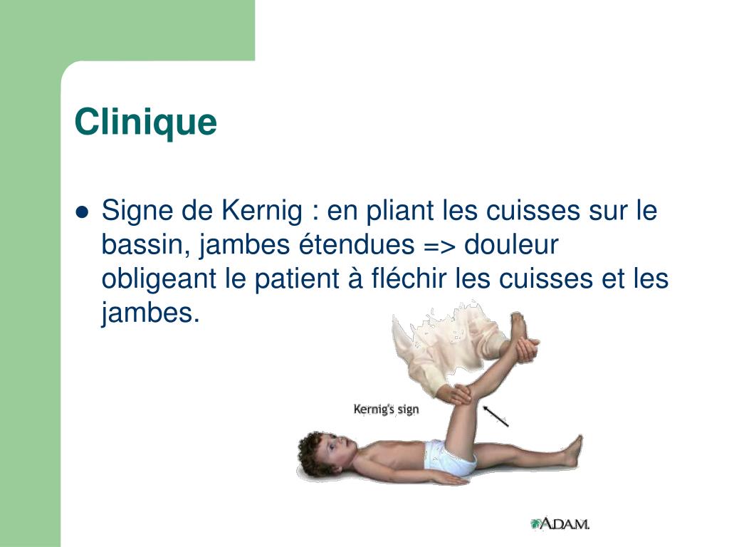 PPT - Méningites et Méningo-encéphalites PowerPoint Presentation, free ...