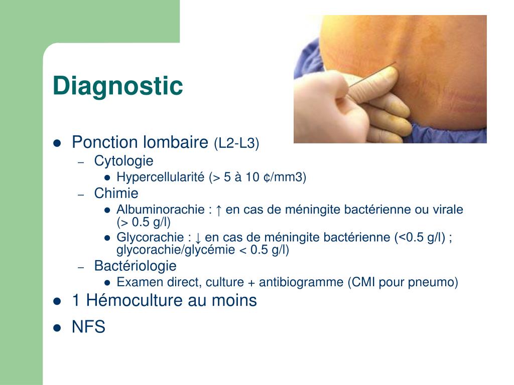 PPT - Méningites et Méningo-encéphalites PowerPoint Presentation, free ...
