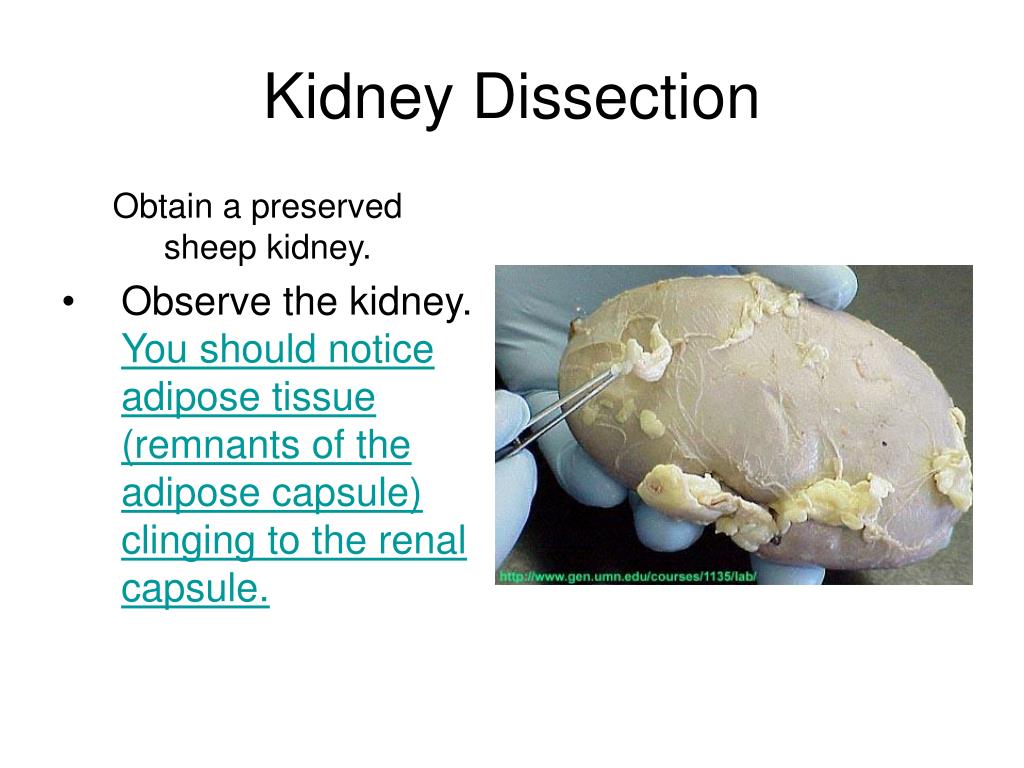 PPT Kidney Dissection PowerPoint Presentation Free Download ID 996817 PPT Kidney Dissection PowerPoint Presentation Free Download ID 996817