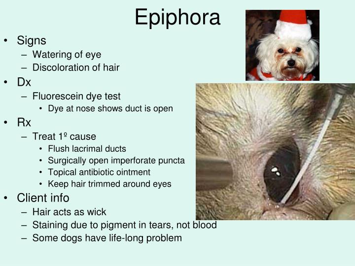 PPT - Ophthalmic Diseases PowerPoint Presentation - ID:998440